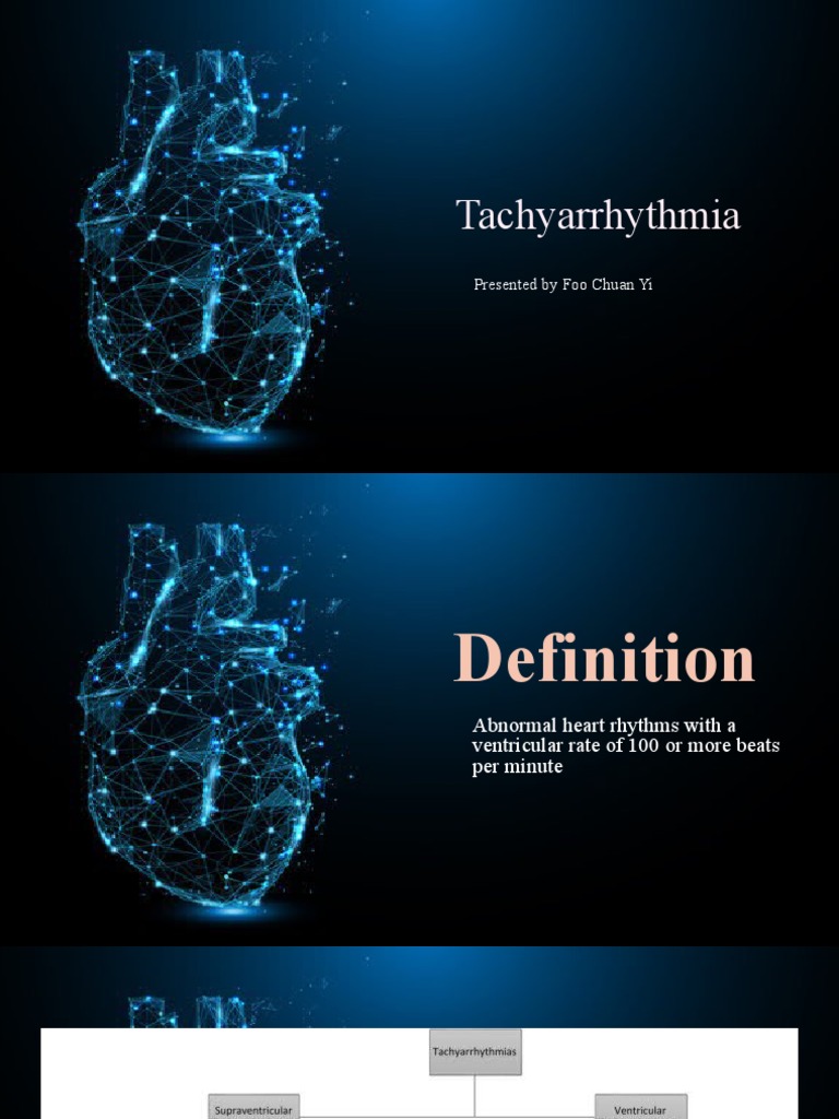 Tachyarrhythmia | PDF | Electrocardiography | Atrium (Heart)