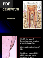Cementoenamel Junction An Insight | PDF | Human Tooth | Tooth Enamel