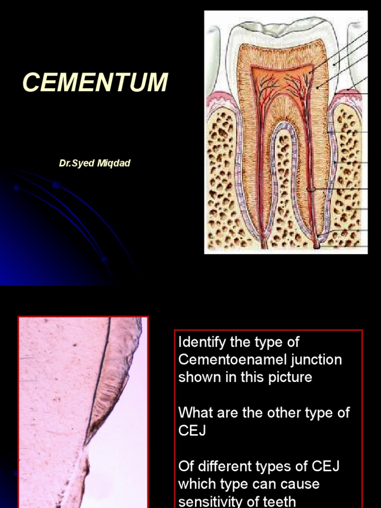Cementoenamel Junction