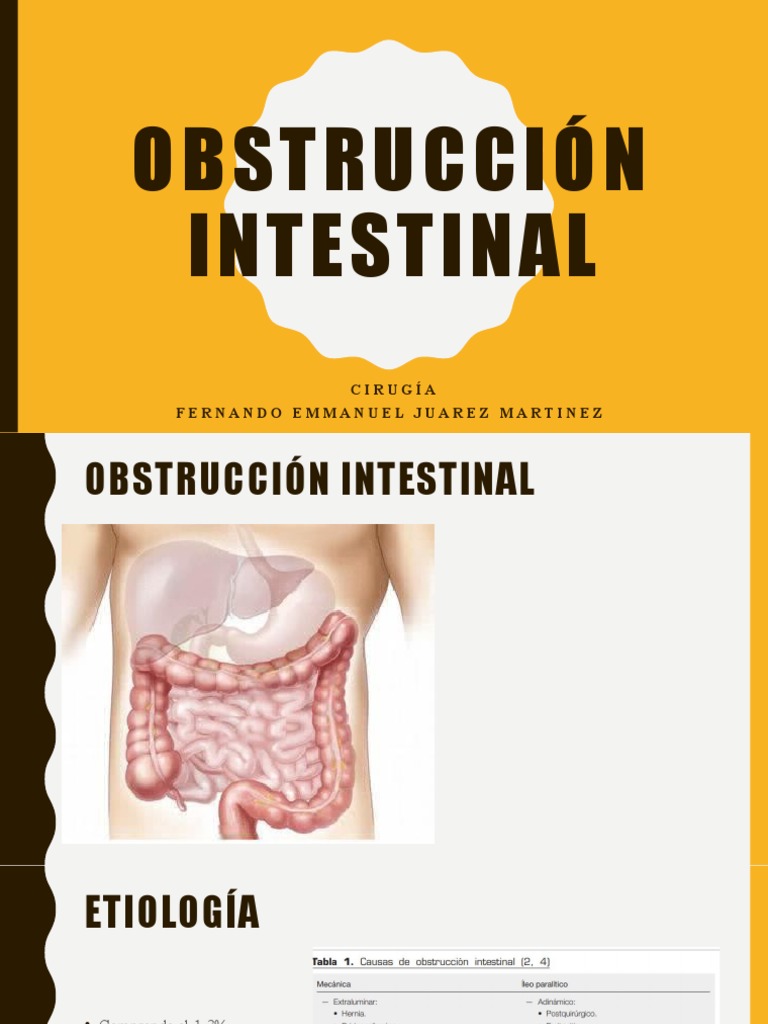 Obstrucción Intestinal | PDF