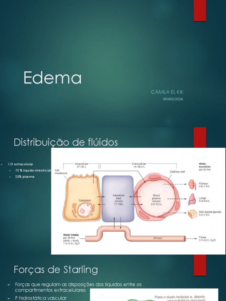 Semiologia - Edema (Camila El Kik) | PDF | Edema | Angiologia