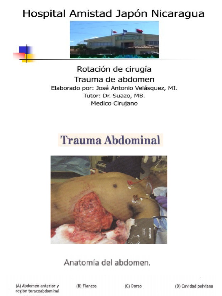 Trauma de Abdomen | PDF