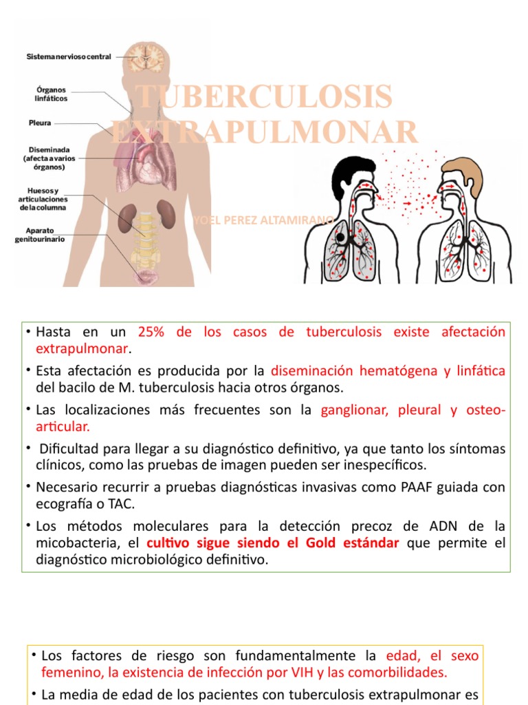 Tuberculosis Extrapulmonar | PDF | Tuberculosis | Medicina CLINICA