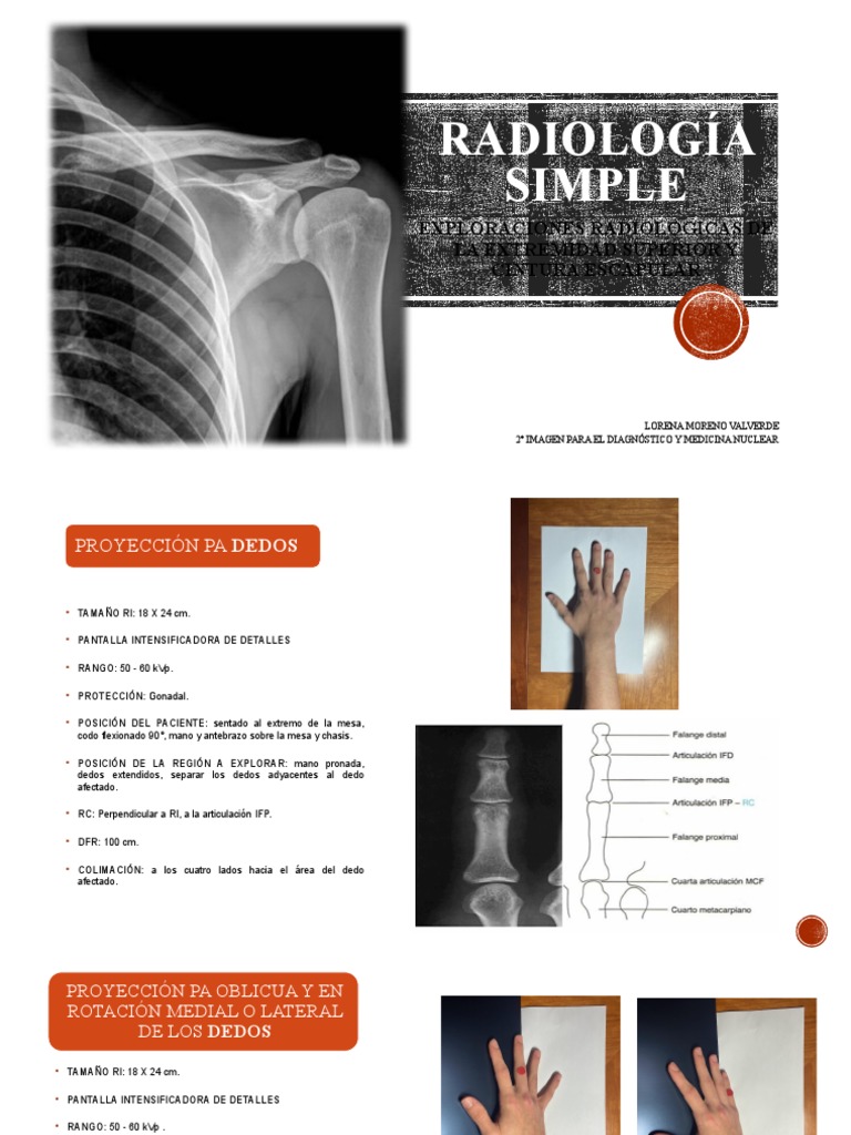 Lorena Moreno Rad. Simple | PDF | Hombro | Mano