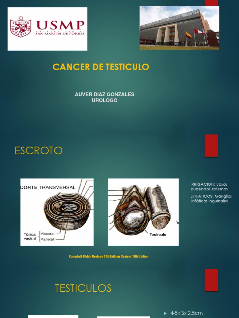 Cancer De Testiculo Pdf Neoplasias Cáncer