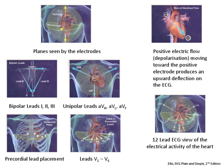 12_Lead_ECG_3D_View | PDF