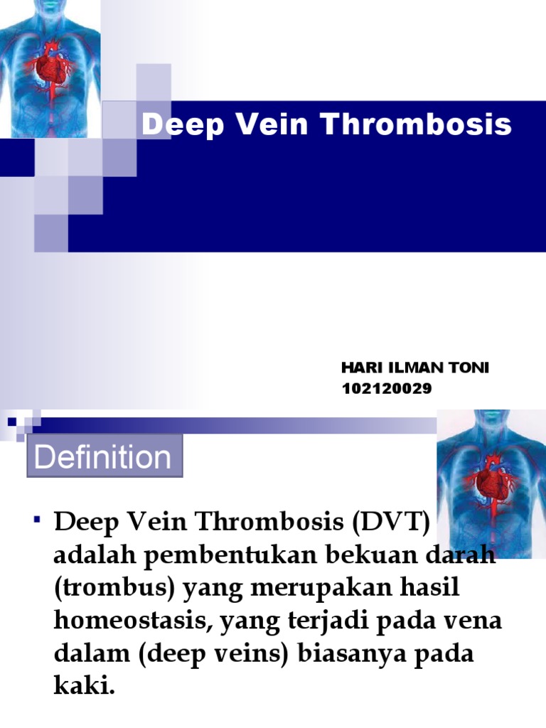 Panduan Lengkap Deep Vein Thrombosis | PDF