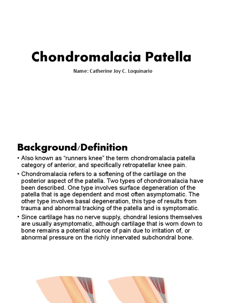 Chondromalacia Patella | PDF