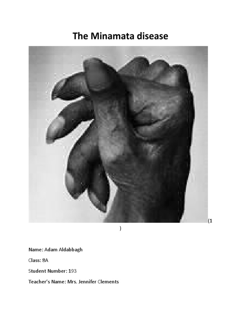 The Minamata Disease | PDF