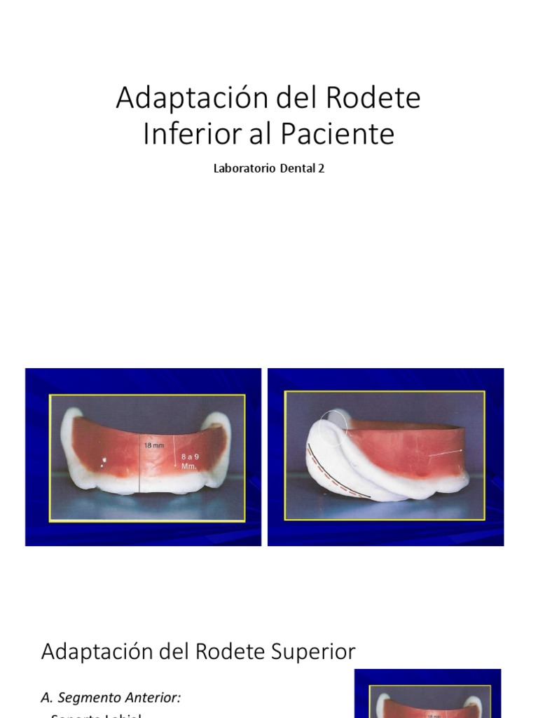 Adaptación Del Rodete Inferior Al Paciente | PDF | Dentadura postiza ...