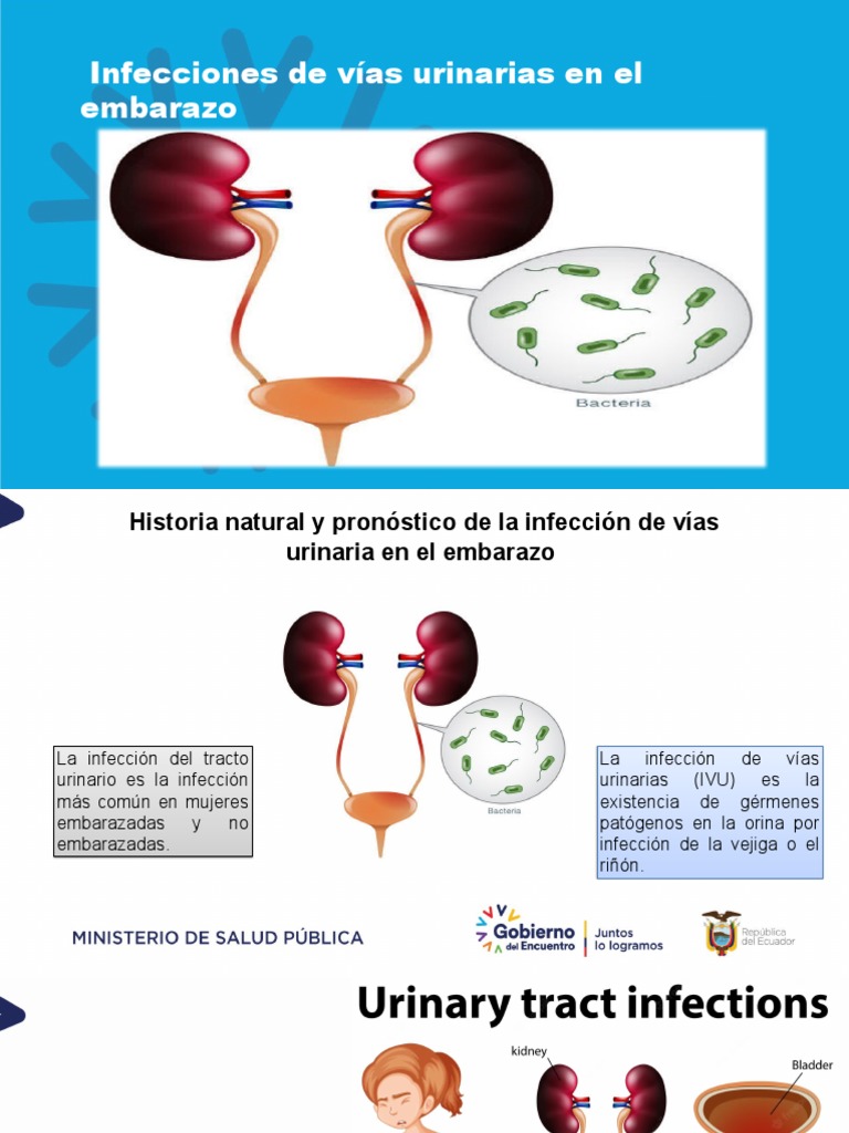 ITU en El Embarazo | PDF | Infección del tracto urinario | Sistema ... ITU en El Embarazo | PDF | Infección del tracto urinario | Sistema ...