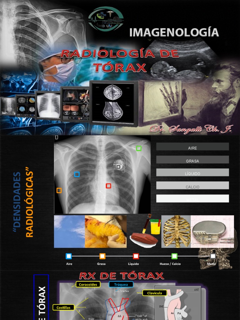 Radiologia y Tomografia de Torax | PDF | Pulmón | Tórax