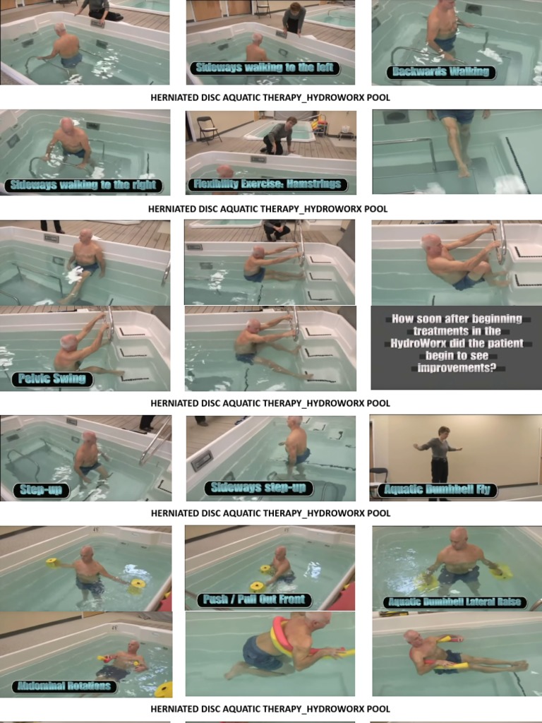 Herniated Disc Aquatic Therapy - HydroWorx Pool | PDF