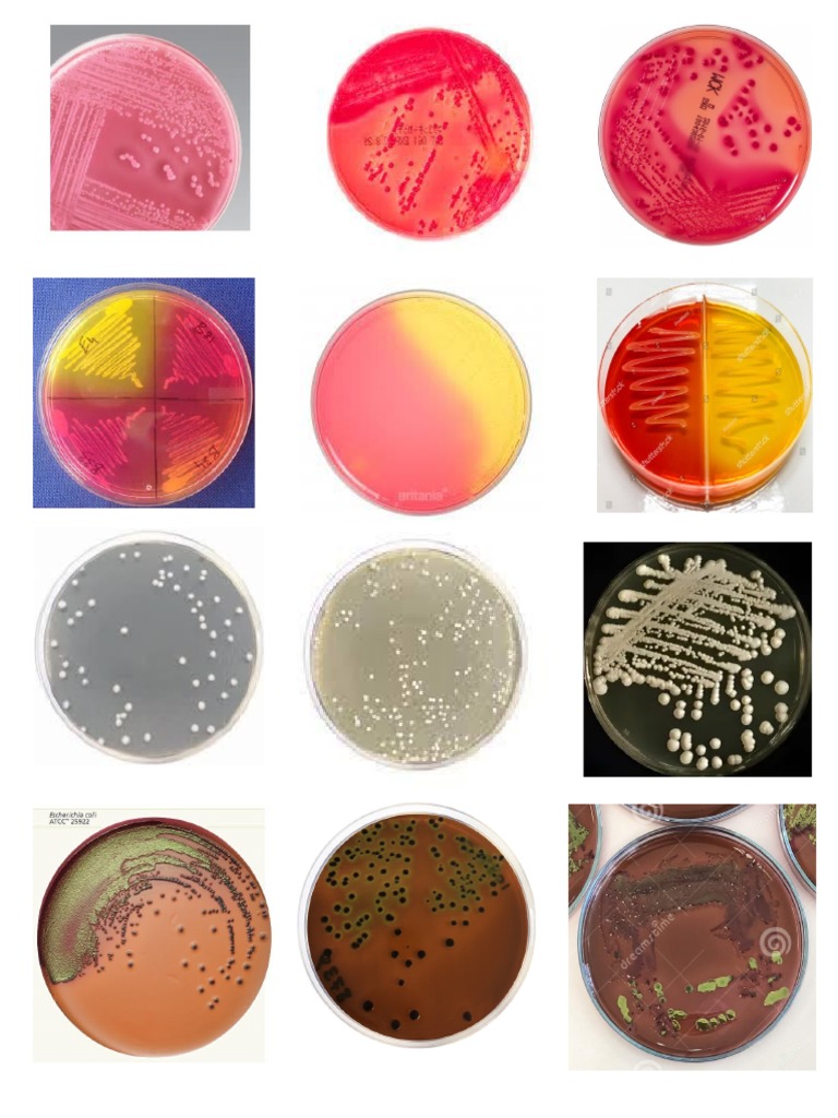 AGAR MICROBIOLOGIA | PDF