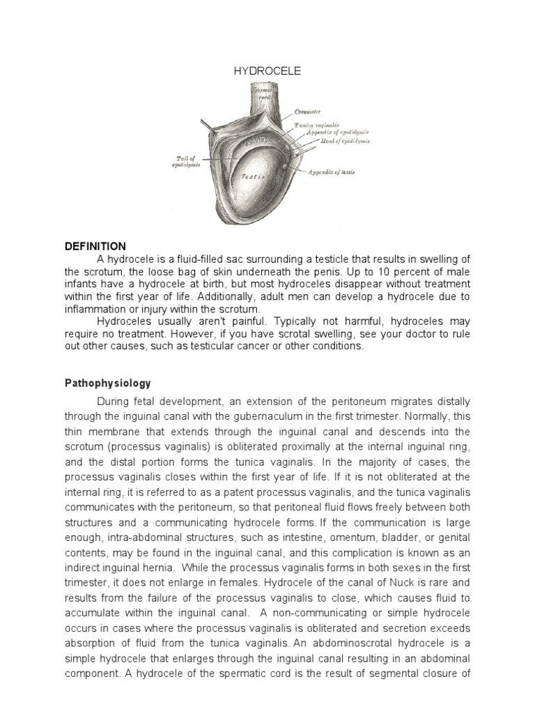 HYDROCELE | PDF | Health Sciences | Medical Specialties
