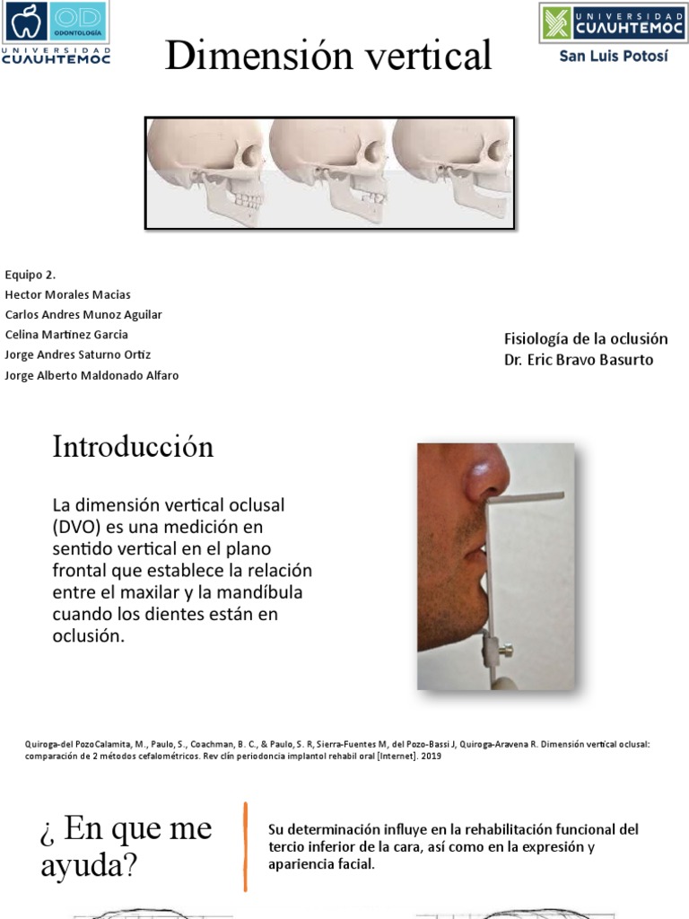 Dimension Vertical MTZ | PDF