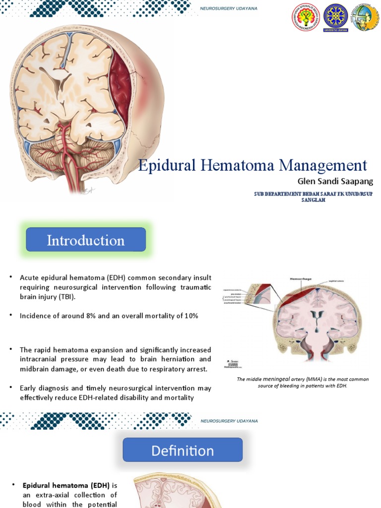 Epidural Hematome Management | PDF | Traumatic Brain Injury | Medical ...