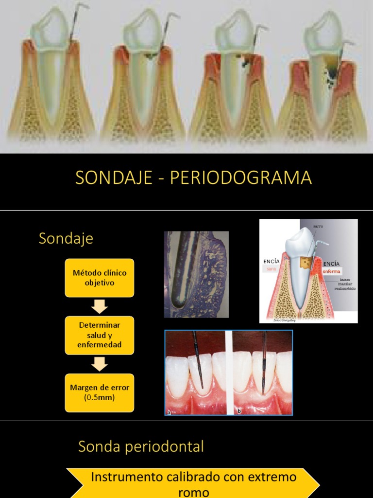 Sondaje Periodontograma Formato Nuevo 3 | PDF | Enfermedades y ...