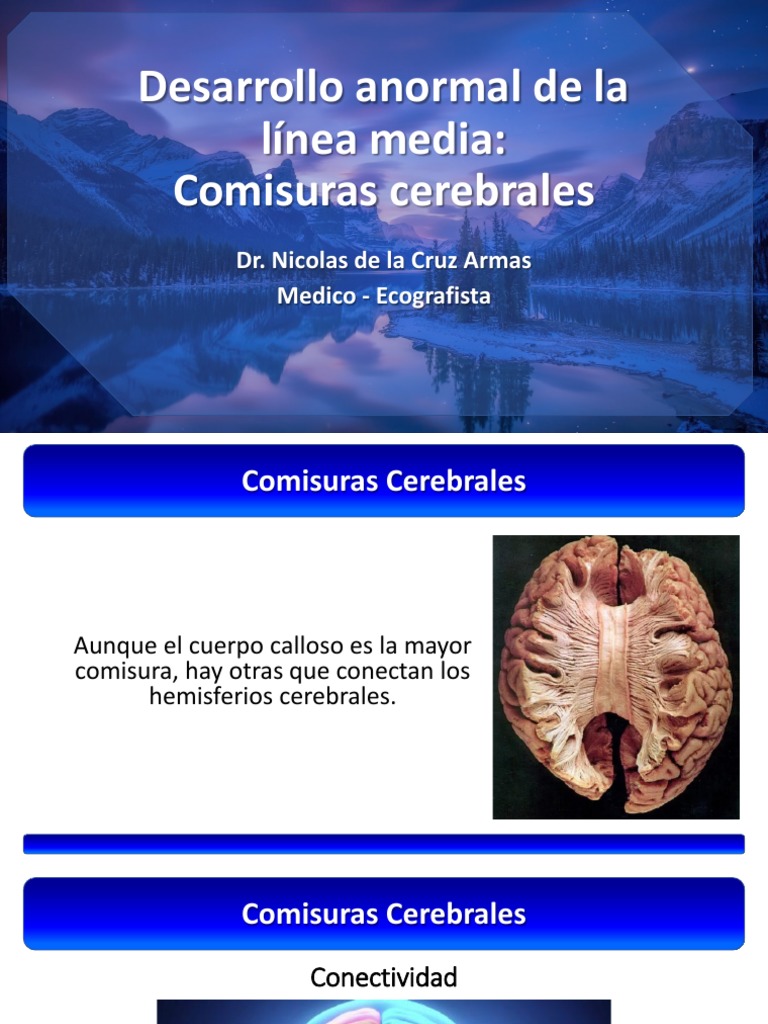 Mod 5 Desarrollo Anormal de La Línea Media EXPO | PDF | Cerebro | Hipocampo