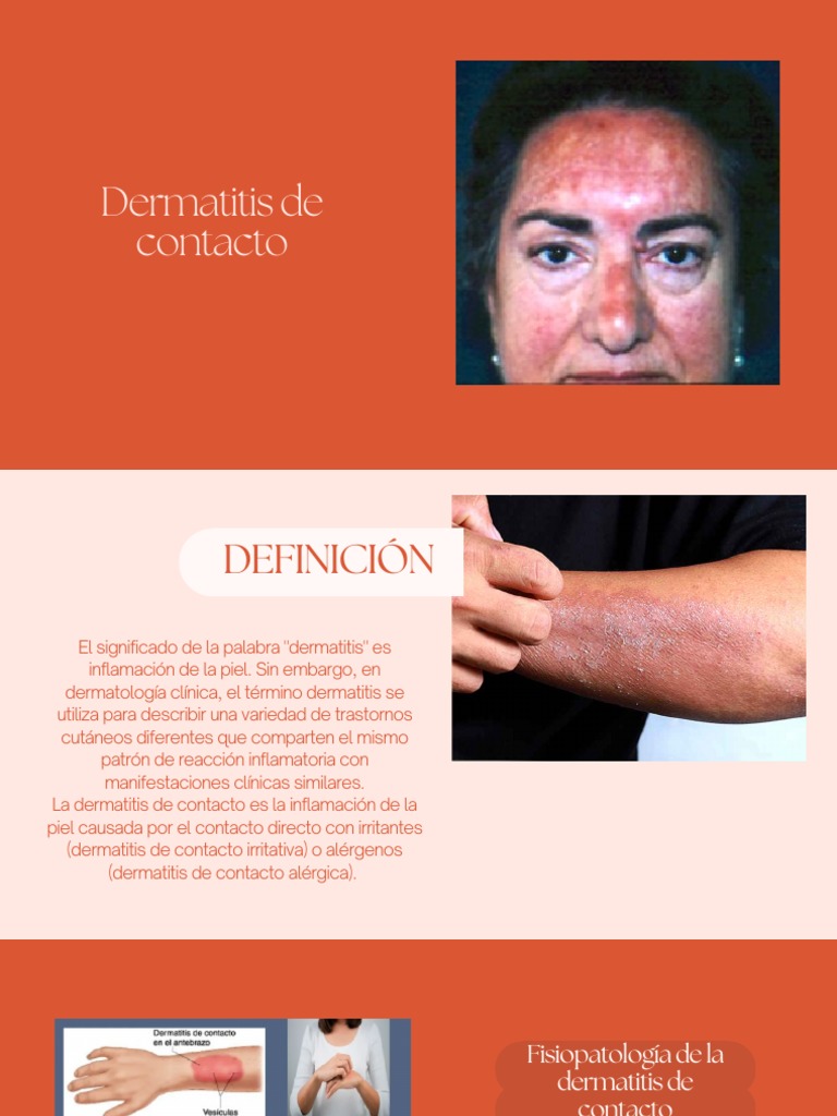 Guía sobre Dermatitis de Contacto | PDF | Alergia | Inmunología