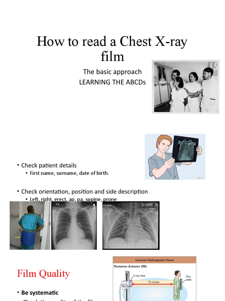 How To Read A Chest X-Ray film-SWUSM | PDF | Thorax | Lung