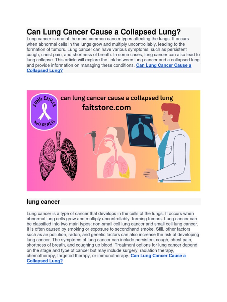 Can Lung Cancer Cause A Collapsed Lung | PDF | Lung Cancer | Cancer