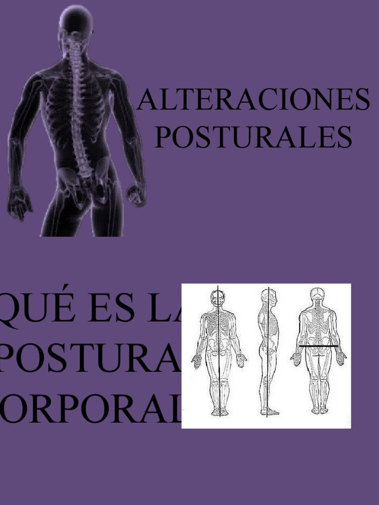 Alteraciones Posturales | PDF | Trastornos musculoesqueléticos ...
