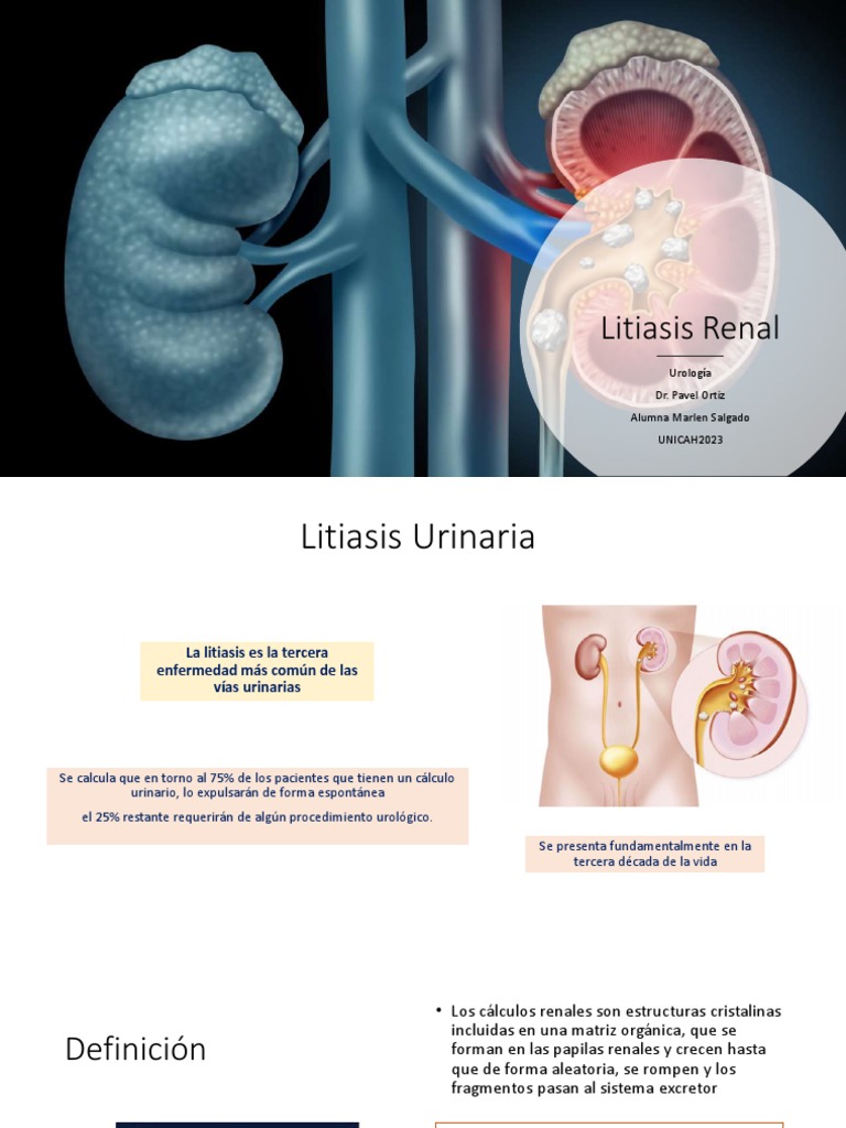 8 Litiasis Renal | PDF | Calcio | Sistema urinario