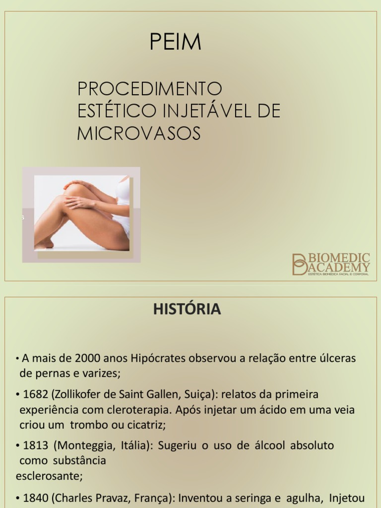 eBook+Peim | PDF | Varizes | Veia