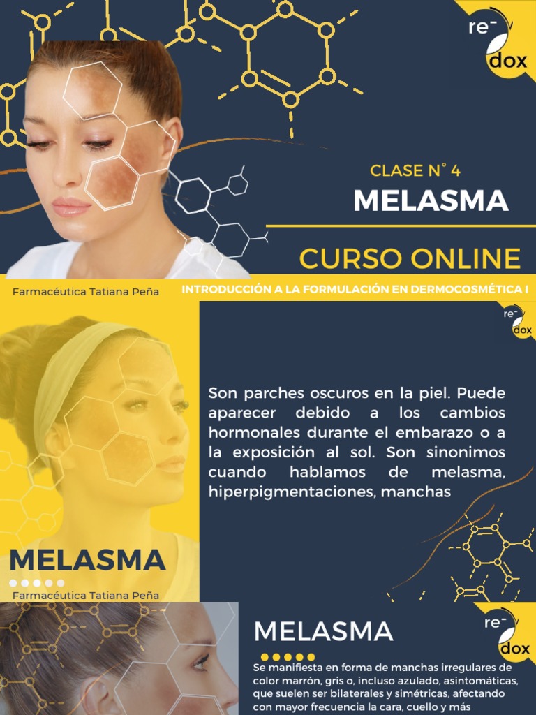 Clase 4 Melasma | PDF | Piel | Causas de la muerte