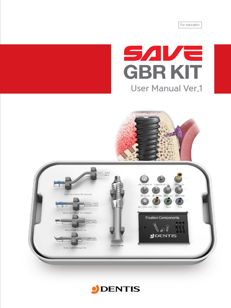 Save GBR Kit Eng 20190115 | PDF | Dental Implant | Screw