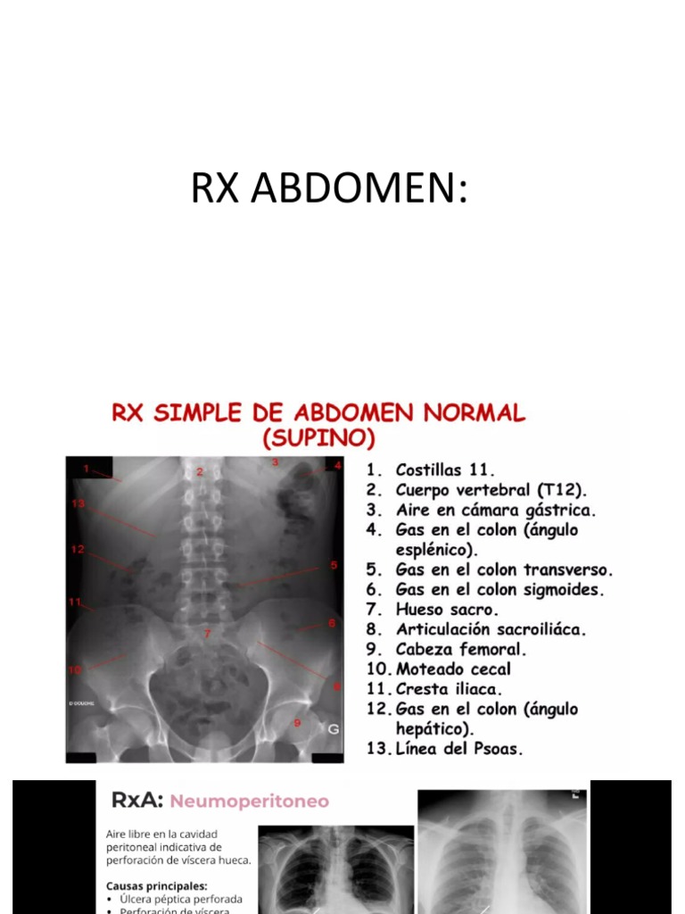 Radiografia de Abdomen | PDF