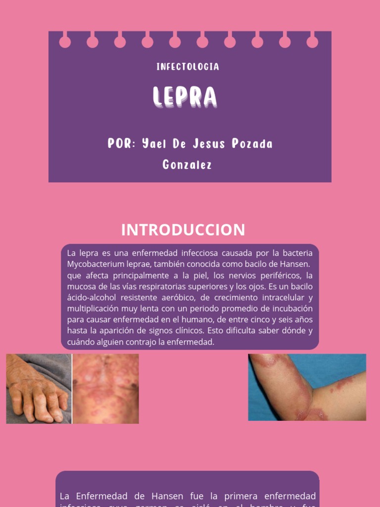 Lepra: Síntomas, Diagnóstico y Tratamiento | PDF | Lepra | Tuberculosis