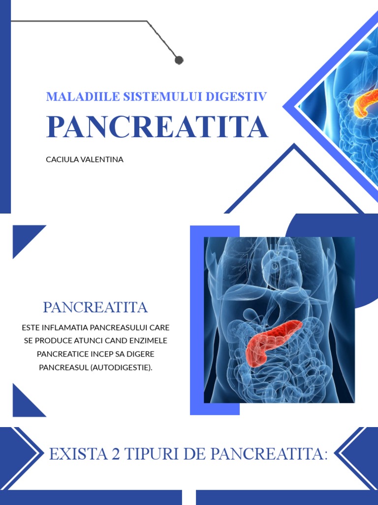 Pancreatita | PDF
