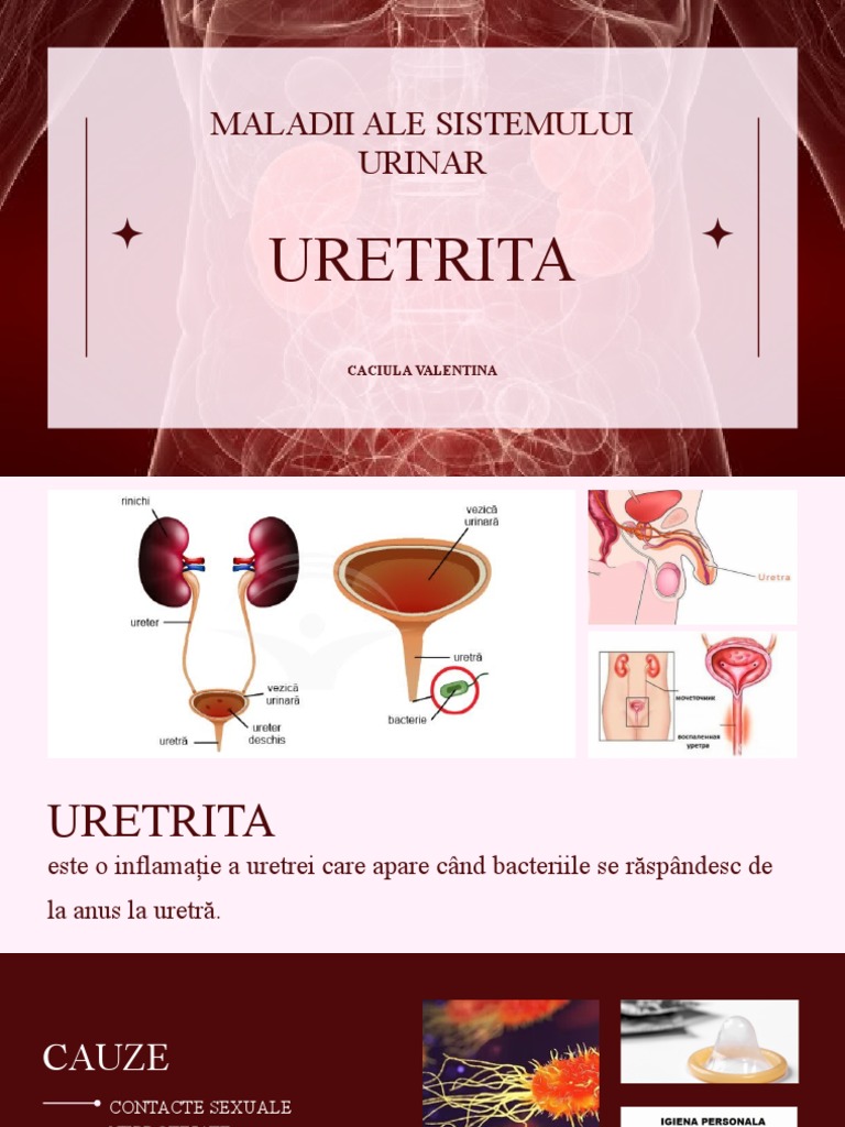 Uretrita | PDF