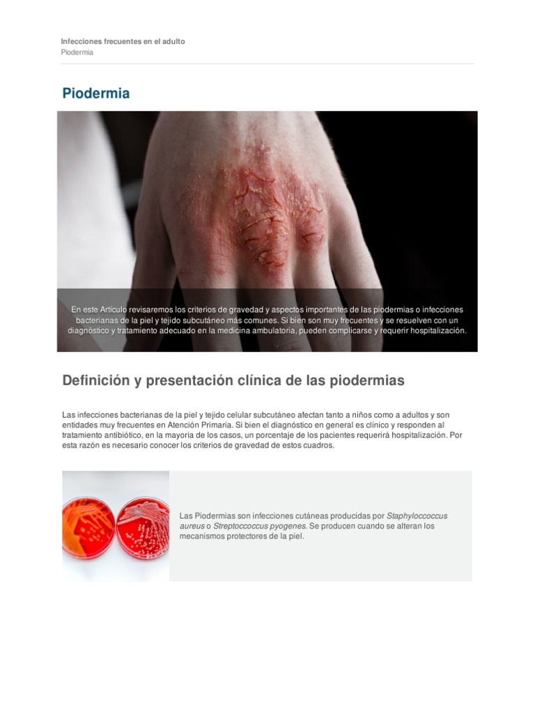 Piodermia 5edb0b95c5ff2 | PDF | Dermatología | Condiciones cutáneas