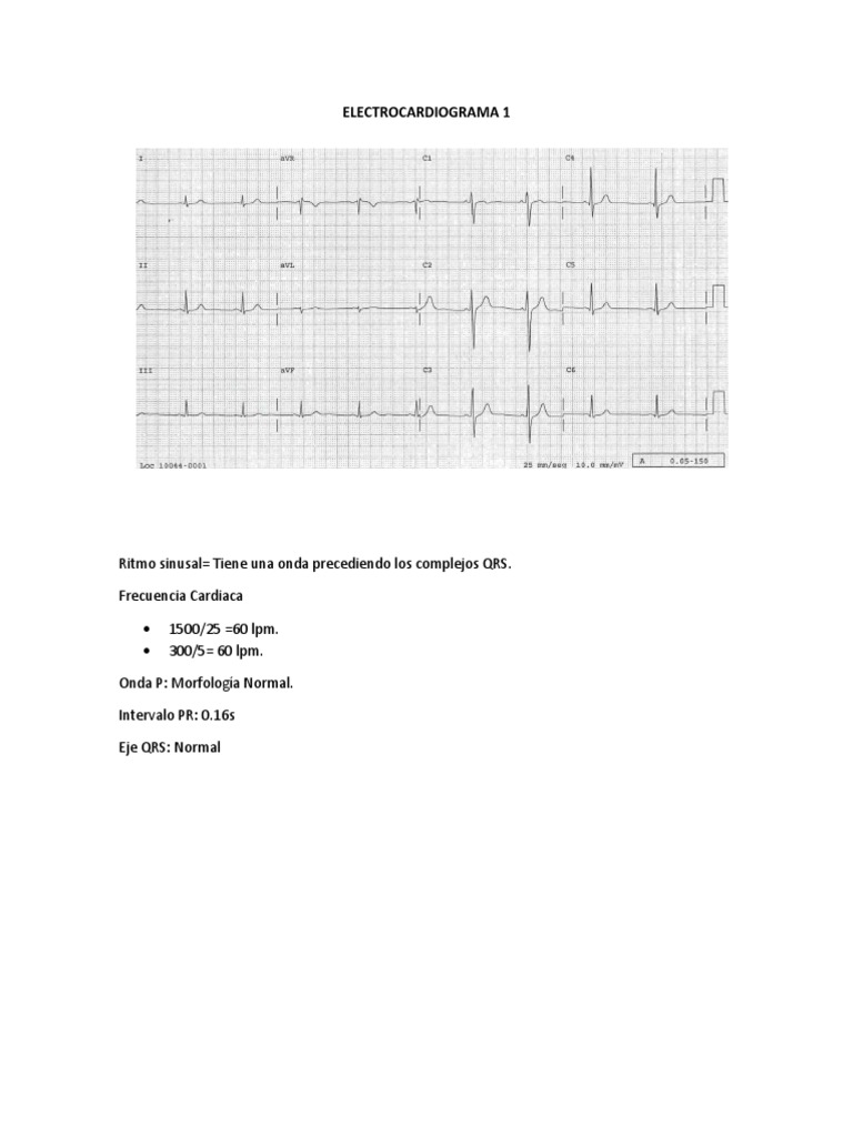 ELECTROCARDIOGRAMA 1 | PDF