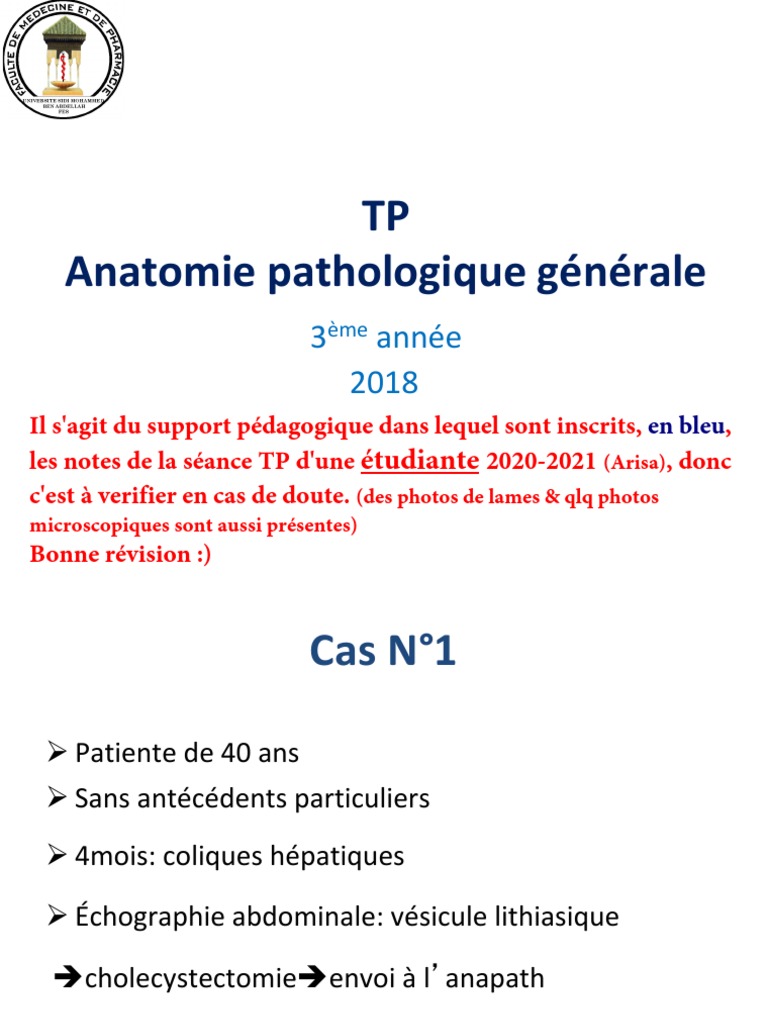 # TP Anapath | PDF | Thyroïde | Inflammation