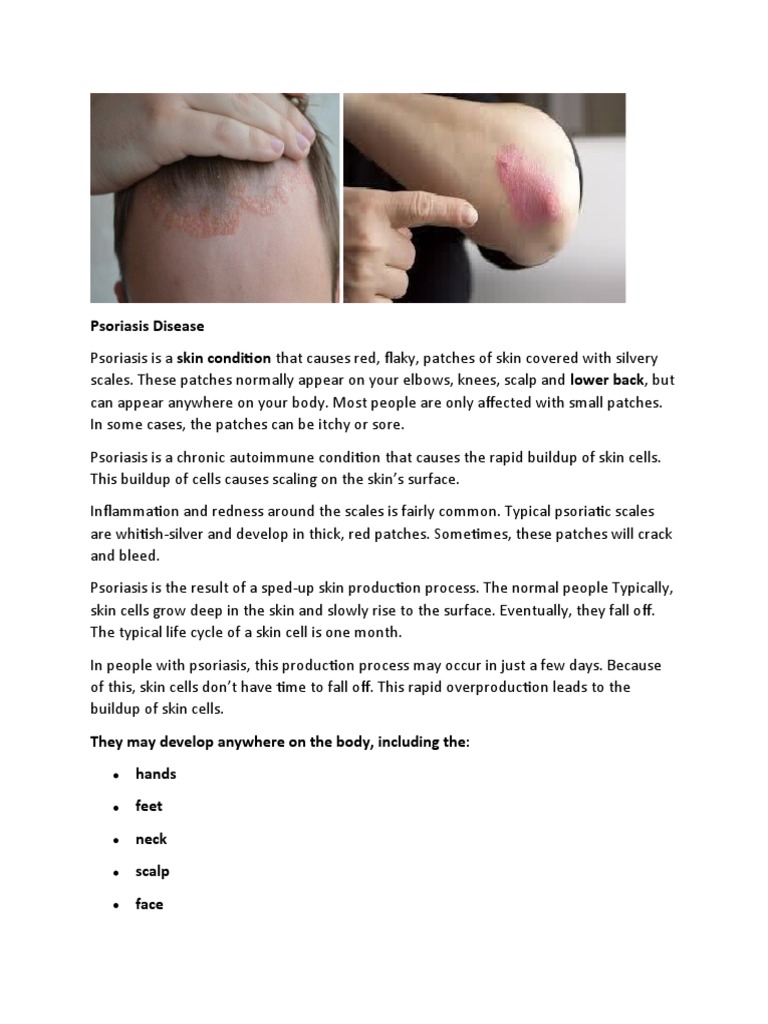 Homework of Basic Communication Skill Lecture 4 | PDF | Psoriasis ...