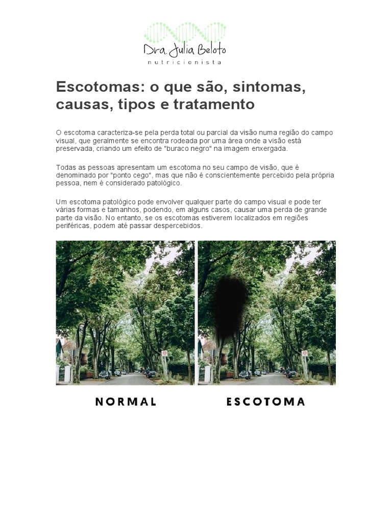 Tipos de Escotoma | PDF | Sistema visual | Enxaqueca