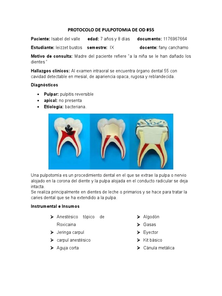PROTOCOLO DE PULPOTOMIA 55 | PDF