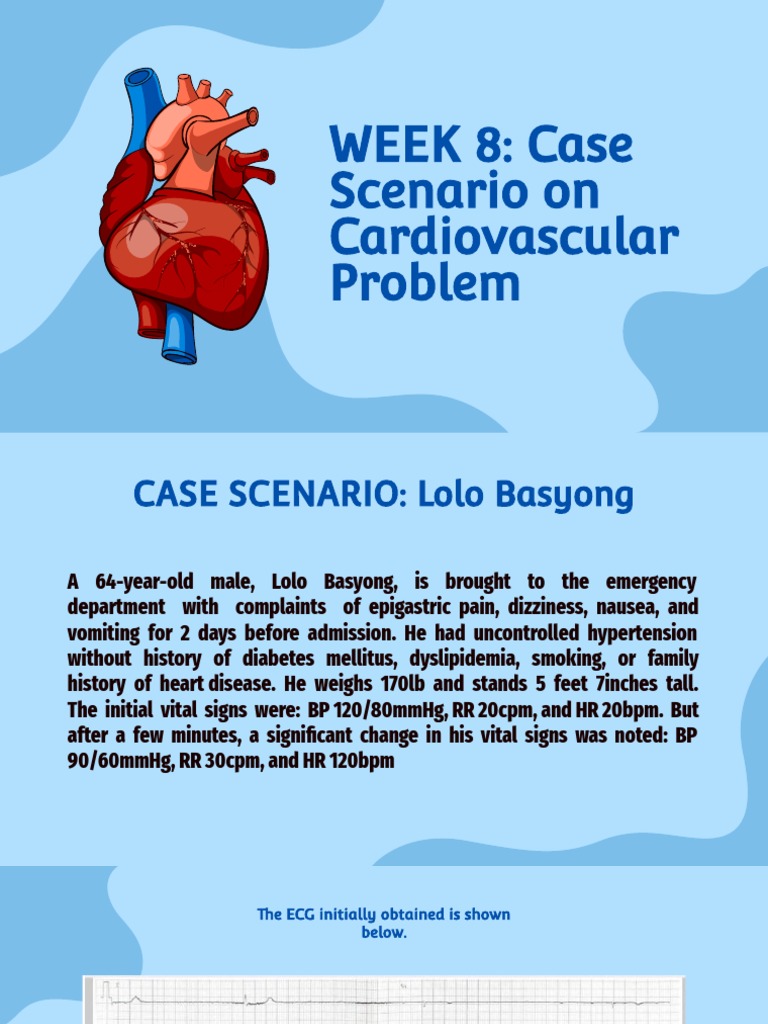 Acute Inferior Wall MI Case Study | PDF | Myocardial Infarction | Coronary Circulation