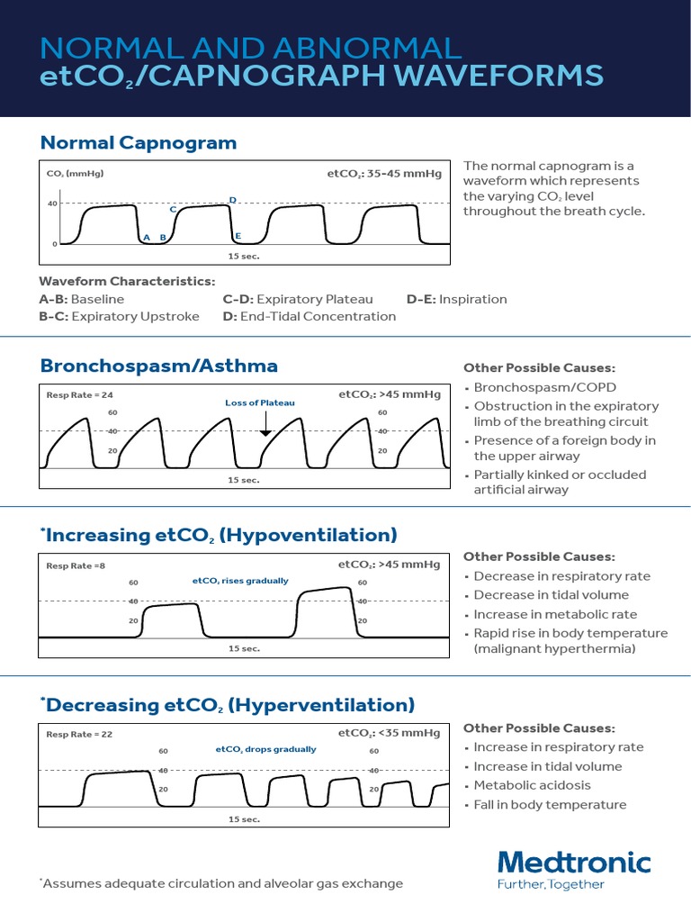 Capnograpy Ems Waveform Reference Card | Download Free PDF | Exhalation ...