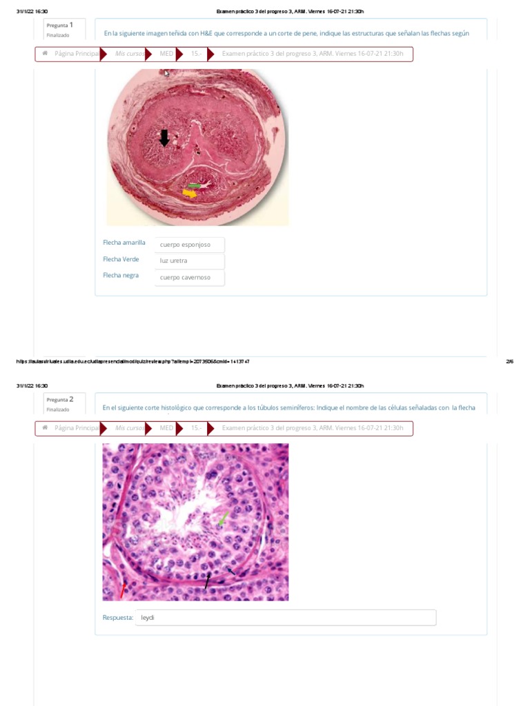 Examen Práctico 3 Del Progreso 3, ARM. Viernes 16-07-21 21 - 30h ...