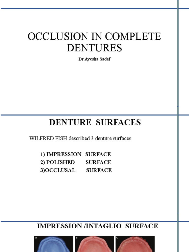 Complete Denture Occlusion | PDF | Dentures | Mouth