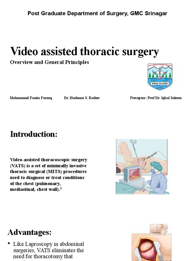 Faaiez VATS | PDF | Surgery | Cardiothoracic Surgery