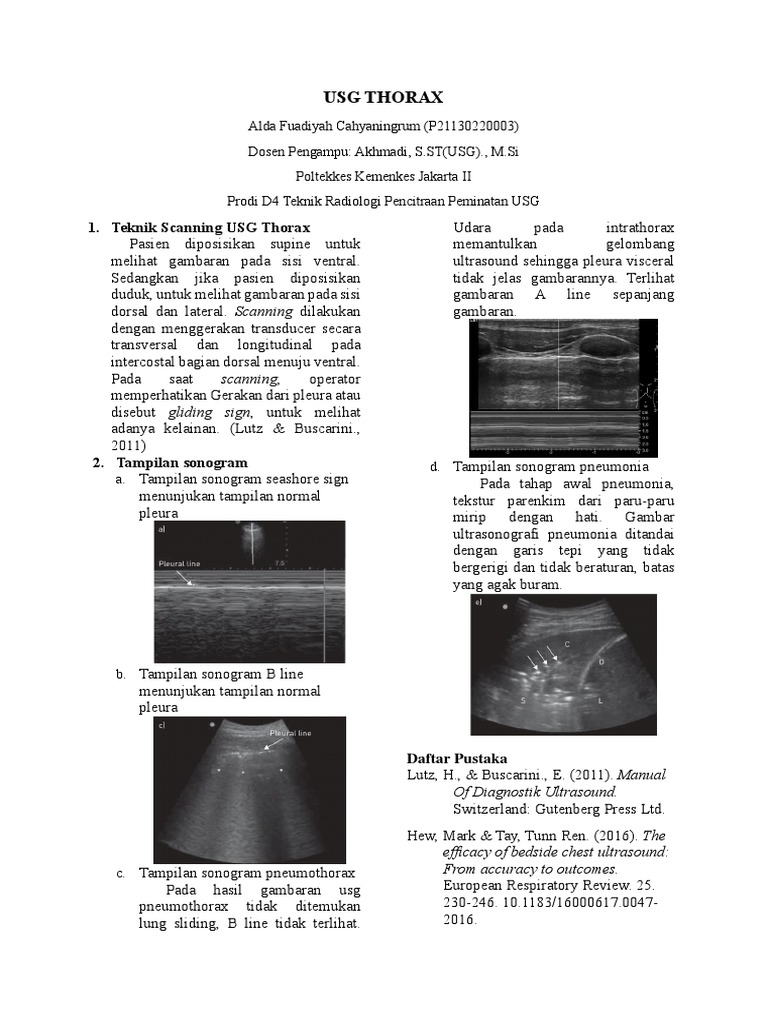 Usg Thorax | PDF