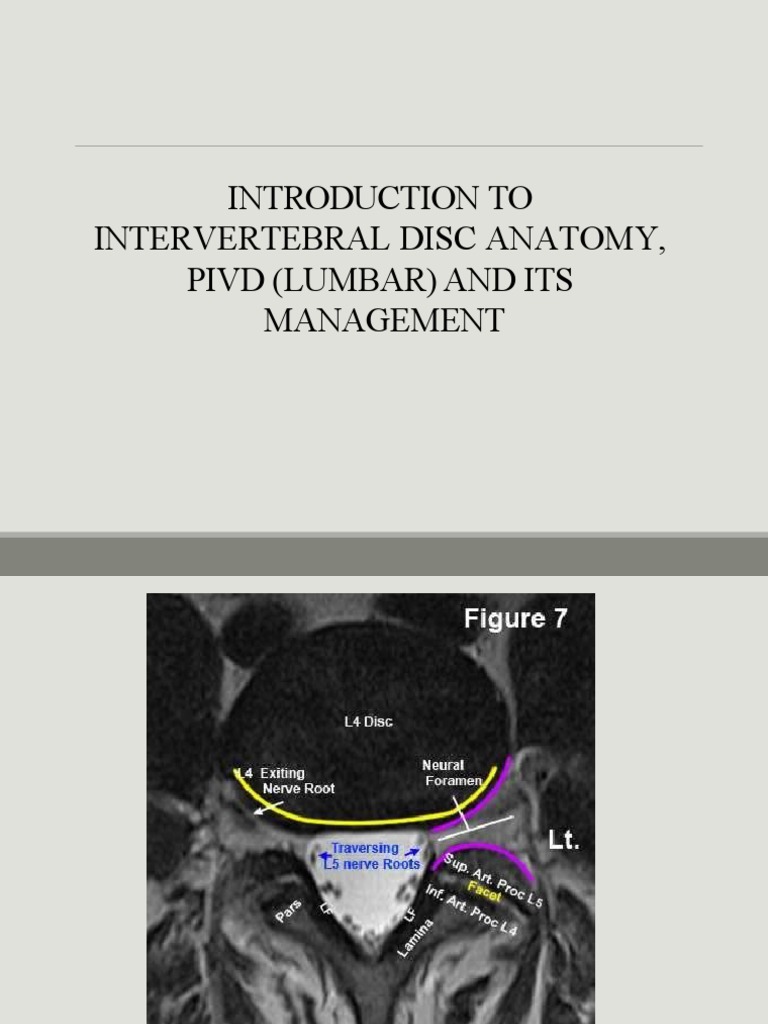 Ivdp | PDF | Vertebral Column | Magnetic Resonance Imaging