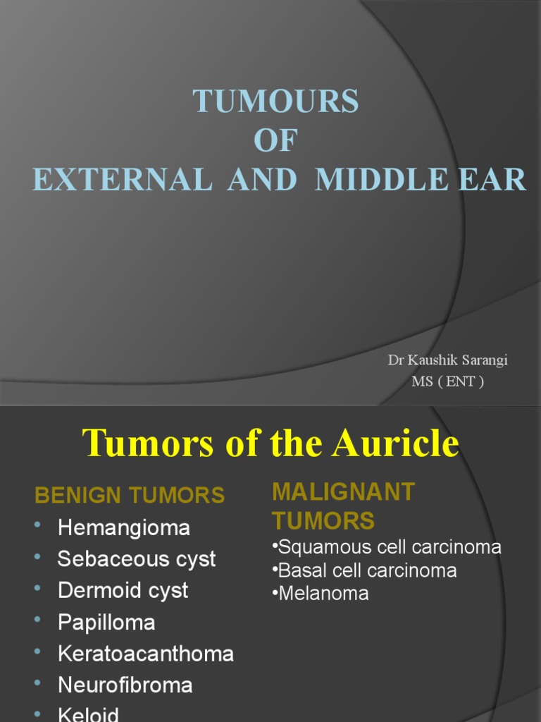 Tumors of Ear: Types and Treatments | PDF | Adenoma | Neoplasms