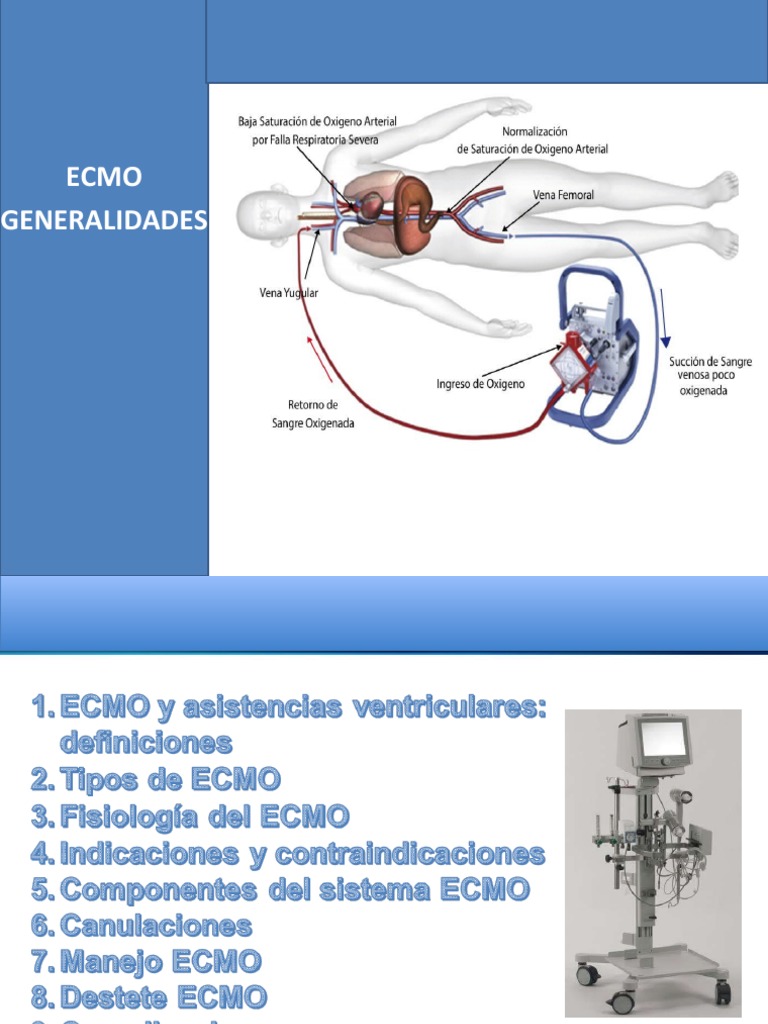 Ecmo | PDF | Sistema circulatorio | Corazón